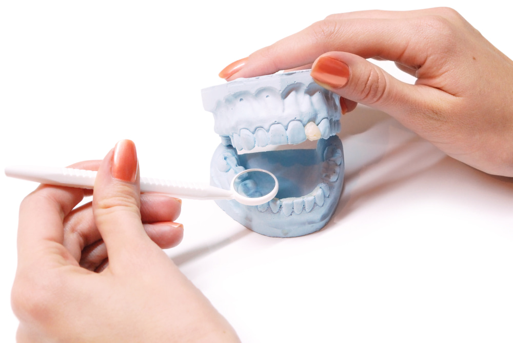 A Guide to Snap-In Dentures | Dental Implants in Scripps Ranch
