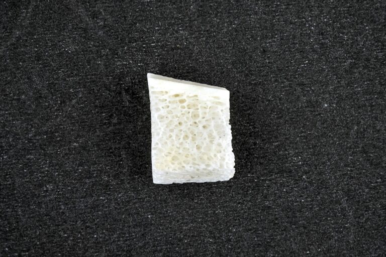 Your Guide to Bone Graft Materials | Autogenous Bone Graft